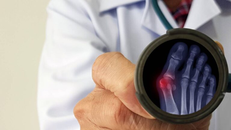 What Happens If Bunion Surgery Doesn't Work? | Tower Foot and Ankle What Happens If Bunion Surgery Doesn't Work? | Tower Foot and Ankle