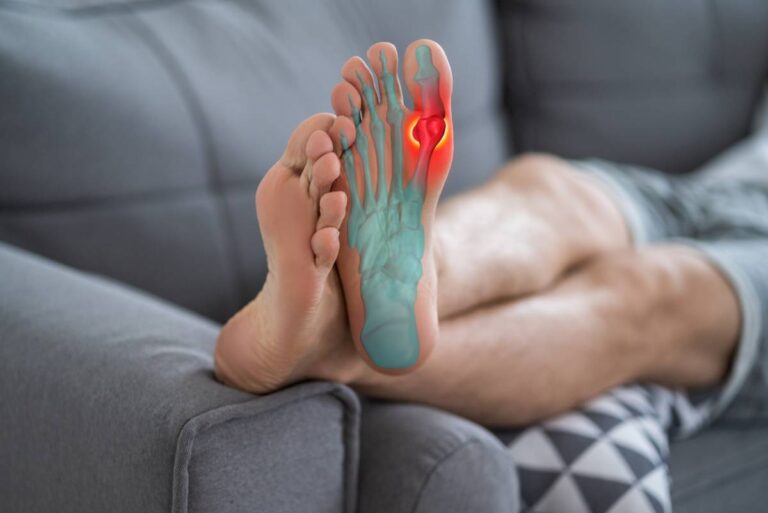 How to Prevent Arthritis in the Foot and Ankle | Tower Foot and Ankle